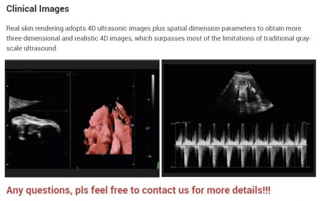 3D 4D 5D Color Doppler Ultrasound Trolley Ultrasound Scanner For OB GYN